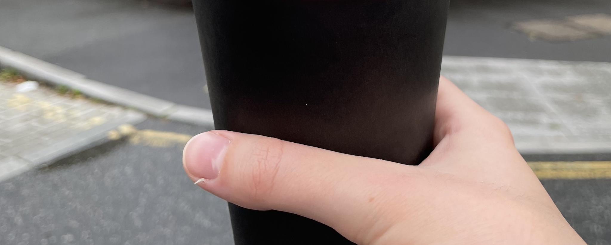 How to remove pesky hangnails